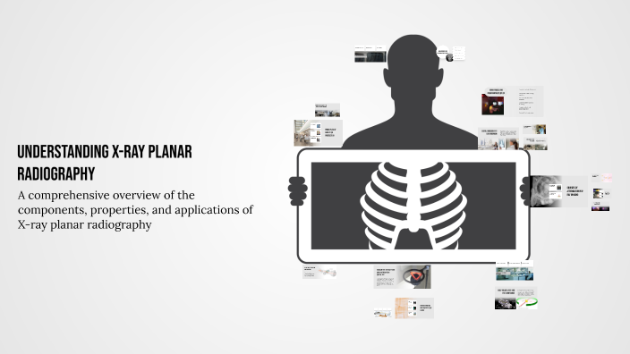 Understanding X-ray Planar Radiography by Sara Nasser on Prezi