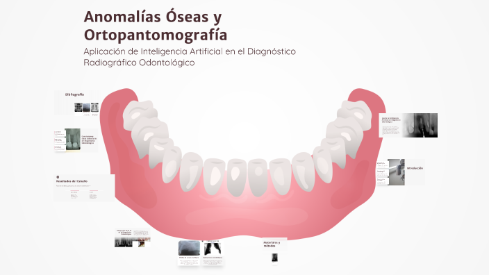Anomalías Óseas y Ortopantomografía by Alba Lozano Abellan on Prezi
