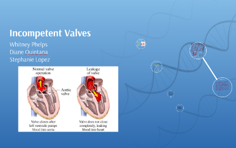 Incompetent Valves by Whitney Phelps on Prezi