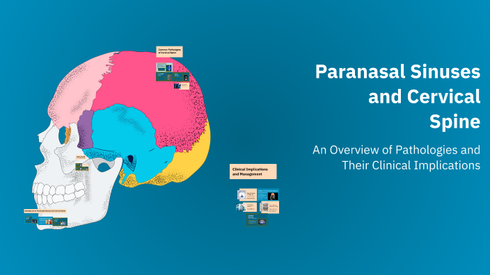 Paranasal Sinuses and Cervical Spine by Nivedetha V on Prezi