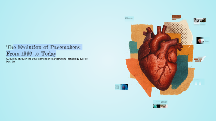 The Evolution of Pacemakers: From 1960 to Today by Alexa Dostaler élève ...