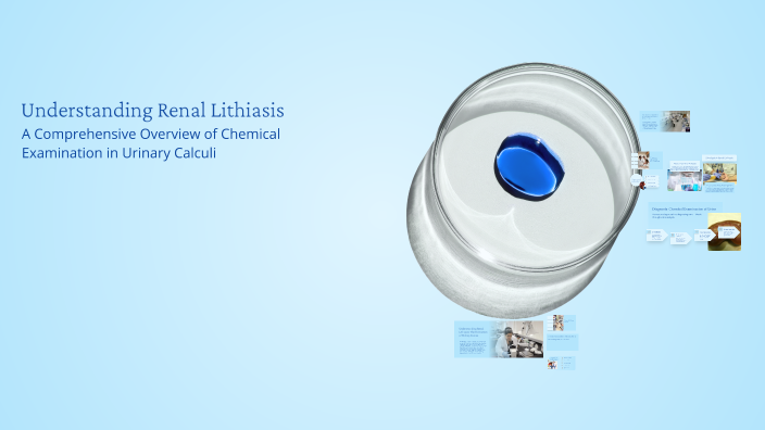 Understanding Renal Lithiasis by GhanaLuxe on Prezi