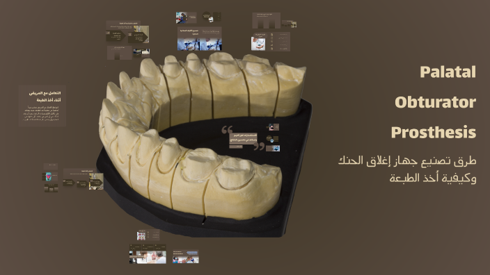 Palatal Obturator Prosthesis by hebah ahmad on Prezi