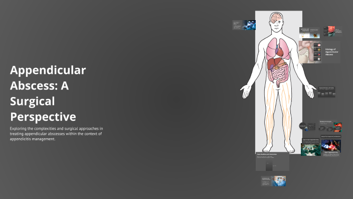Appendicular Abscess: A Surgical Perspective by Dr Siddhartha Sankar ...