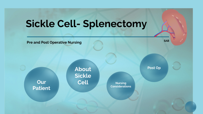 Sickle Cell- Splenectomy by Melissa Balasuriya on Prezi