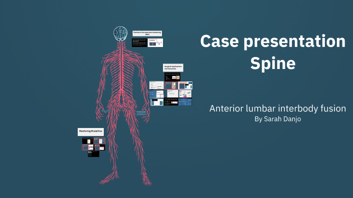 IOM case presentation spine by Sarah Danjo on Prezi