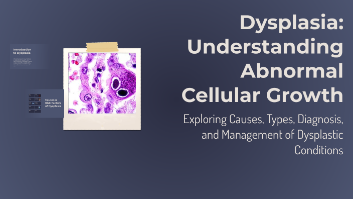 Dysplasia: Understanding Abnormal Cellular Growth by Ban Haider on Prezi