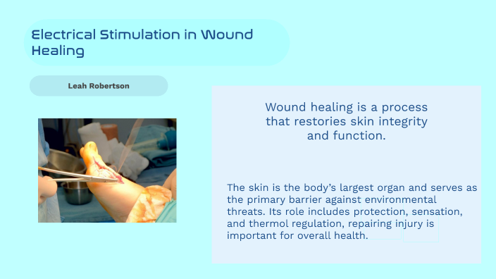 Electrical Stimulation in Wound Healing Leah Robertson by Leah ...