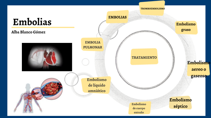 Embolias by Alba Blanco Gómez on Prezi