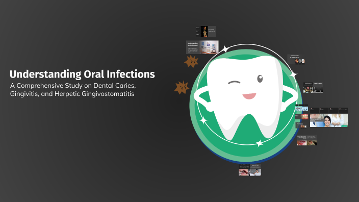 Understanding Oral Infections by Ashlee Sandoval on Prezi