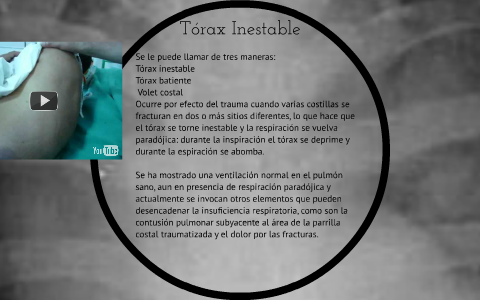 Torax Inestable by jose mora on Prezi