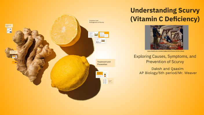 Understanding Scurvy: The Sailor's Disease by Qaasim b on Prezi
