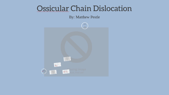 Ossicular Chain Dislocation by Matt Pestle
