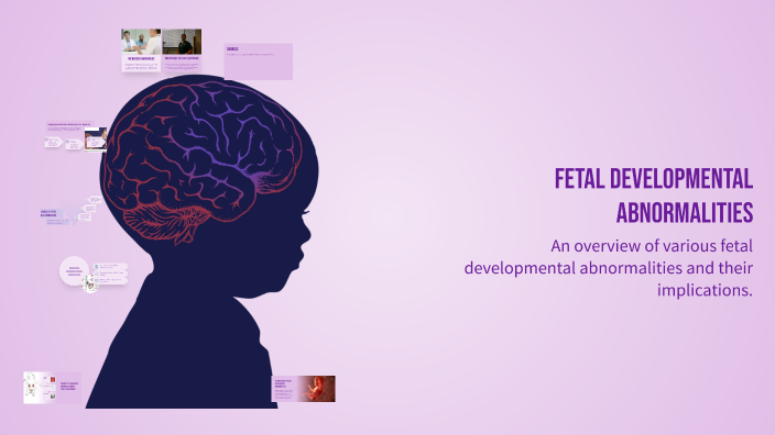 Fetal Developmental Abnormalities by mohamed mezianee on Prezi