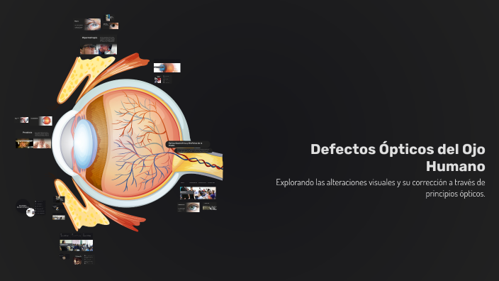 Defectos Ópticos del Ojo Humano by cristofher leonardo acuña on Prezi