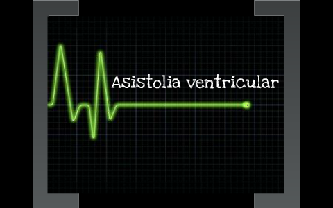 Asistolia ventricular by Camilo Agudelo on Prezi