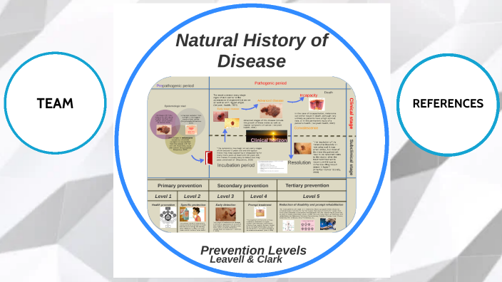 Natural History of Disease (Leavell and Clark's model): Melanoma. by ...