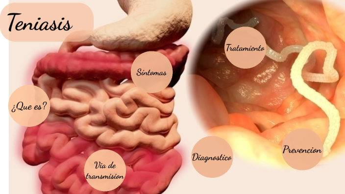 Teniasis by Isabell Hernandez on Prezi