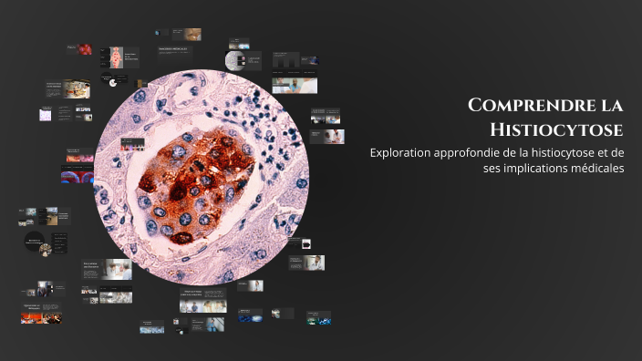 Comprendre la Histiocytose by eya kallel on Prezi