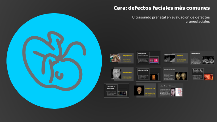 Cara: defectos faciales más comunes - ultrasonido prenatal by Sergio ...