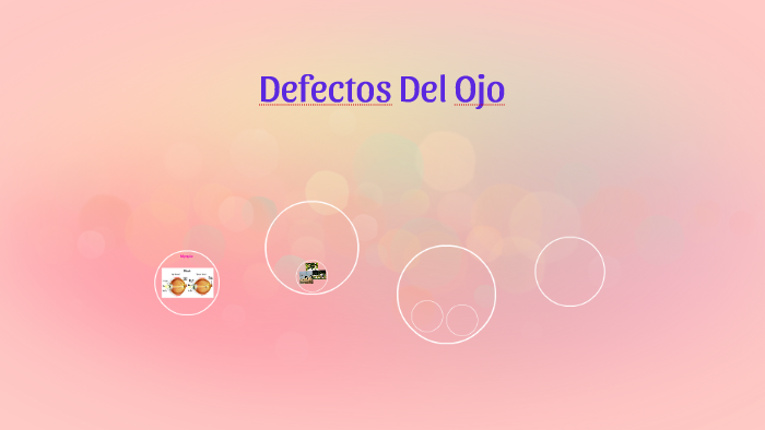 Defectos Del Ojo by anabel Páez Ruiz on Prezi