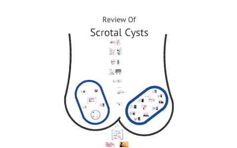 Scrotal Cysts by SAMEH SAIF on Prezi