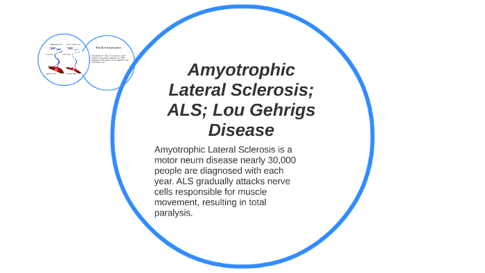 Amyotrophic Lateral Sclerosis; ALS; Lou Gehrigs Disease by Lucy ...