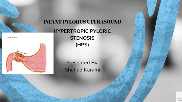 INFANT PYLORUS ULTRASOUND by mohammad kabli on Prezi