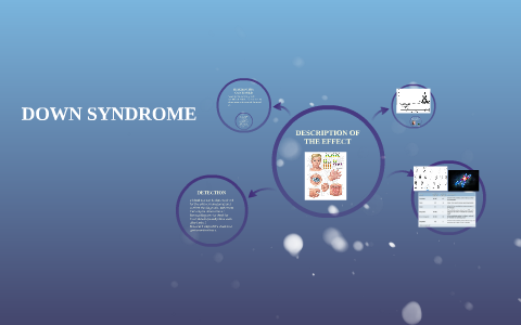 DOWN SYNDROME !!!! by Logan Spotts on Prezi
