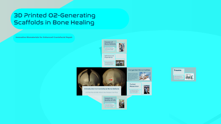 3D Printed O2-Generating Scaffolds in Bone Healing by Haley Bergman on ...