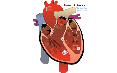 Heart Attack by Human Biology on Prezi