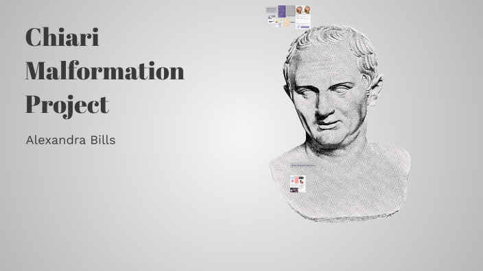 Chiari Malformation Project by Alex Bills on Prezi