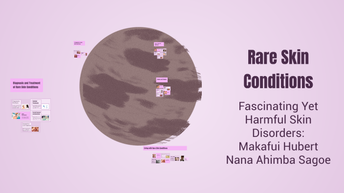 Rare Skin Conditions by Makafui on Prezi