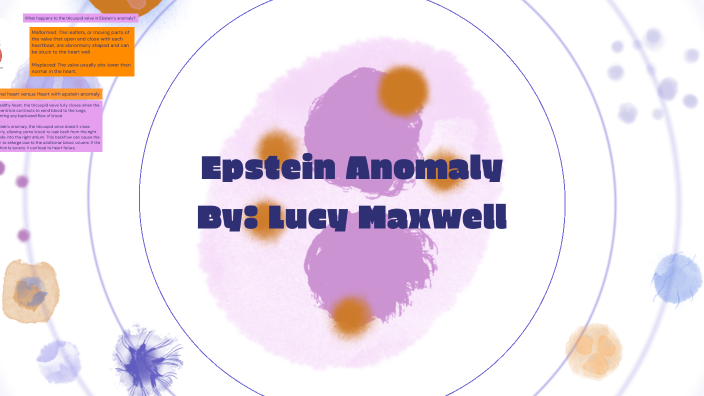 Epstein Anomaly by Lucy Maxwell on Prezi
