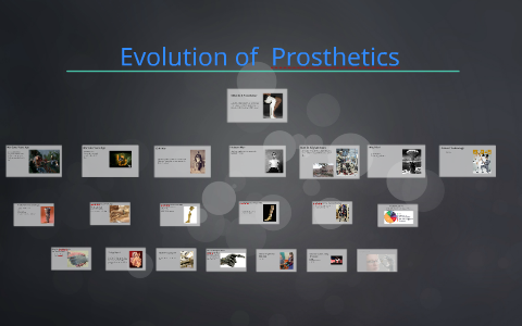 Evolution of Prosthetics by Brian Gomes