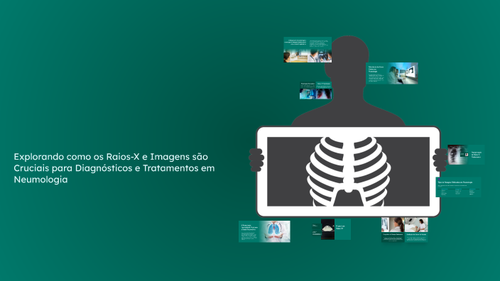 Neumologia: A Importância dos Raios-X e Imagens by Jonathan Mikhail ...