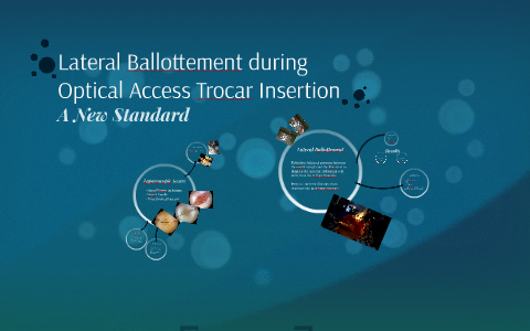 Lateral Ballottement during Optical Access Trocar Insertion: A New ...