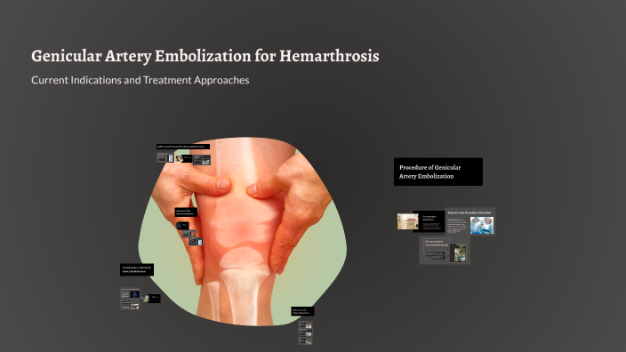 Genicular Artery Embolization for Treatment of Hemarthrosis by juan ...