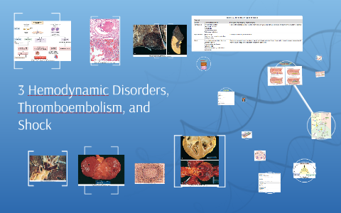 3 Hemodynamic Disorders, Thromboembolism, and Shock by Rony Colanzi