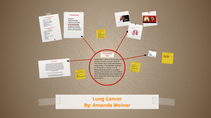 Lung Cancer by Amanda Molnar on Prezi