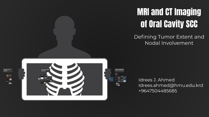 MRI and CT Imaging of Oral Cavity SCC by Idrees Ahmed on Prezi