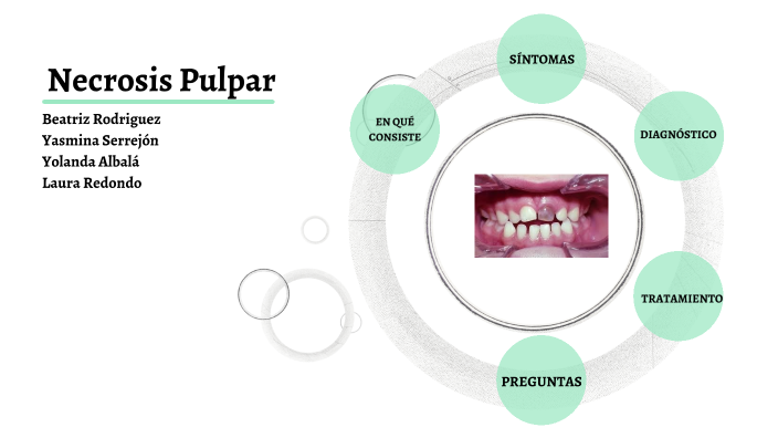 Necrosis pulpar by Beatriz Rodriguez Gomez on Prezi