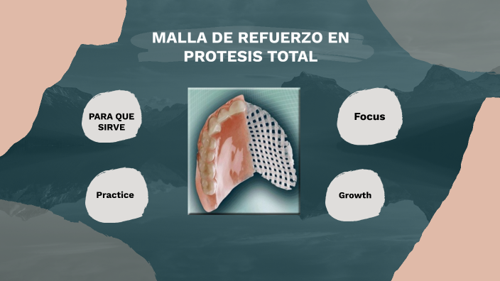 malla de refuerzo en prótesis dental by abner david Lopez on Prezi