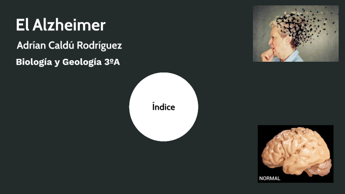 ALZHEIMER by Adrian Caldu on Prezi