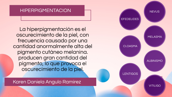 HIPERPIGMENTACION by Karen Daniela Angulo Ramirez on Prezi