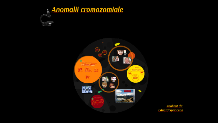 Anomalii cromozomiale autzomale by Eduard Sprincean on Prezi