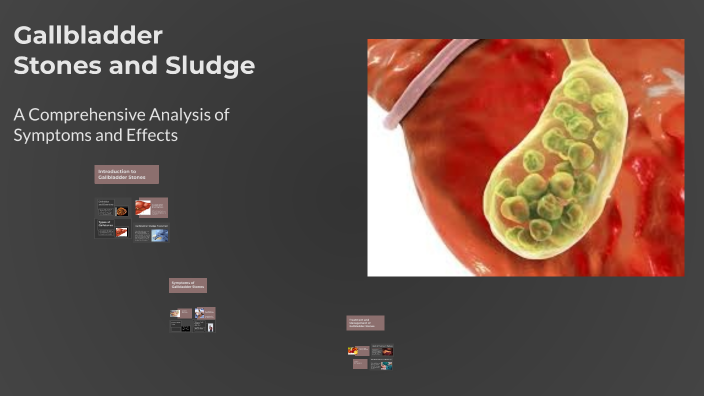 Gallbladder Stones and Sludge by Andres Lara on Prezi