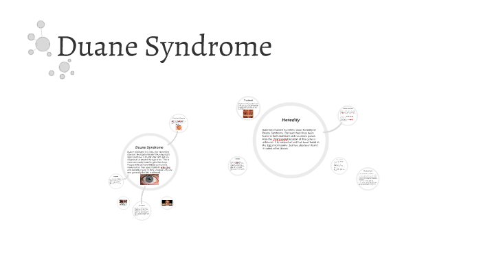Duane Syndrome by Brittany Burroughs on Prezi