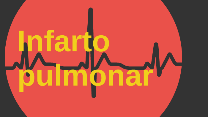 infarto pulmonar by biologia clase on Prezi