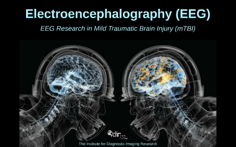 EEG TBI by Tomi Nano on Prezi